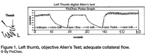 An Objective Allen’s Test