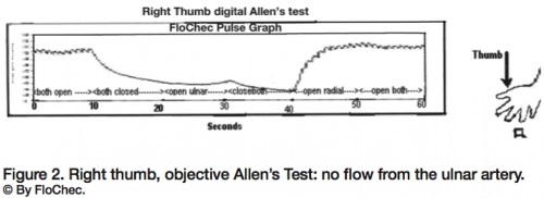 An Objective Allen’s Test