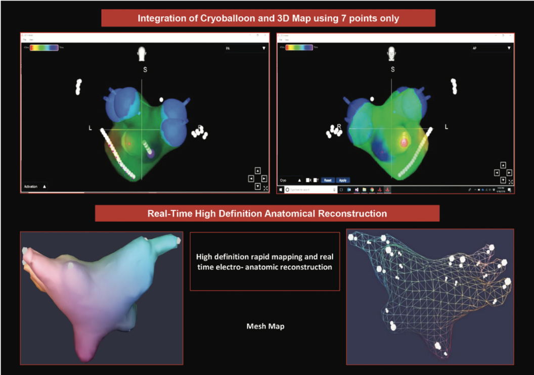 A Novel Approach to Cardiac 3D Mapping