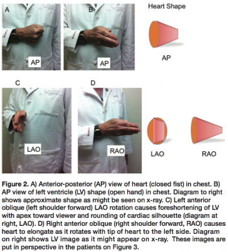 Angiographic Projections Made Simple: An Easy Guide to Understanding ...