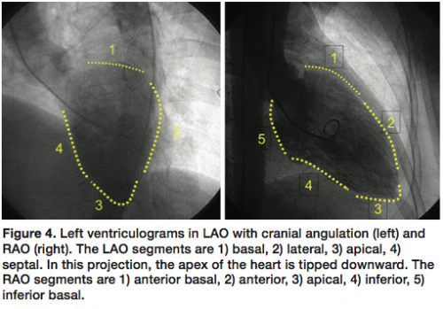 Angiographic Projections Made Simple: An Easy Guide to Understanding ...