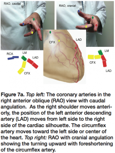Angiographic Projections Made Simple: An Easy Guide to Understanding ...
