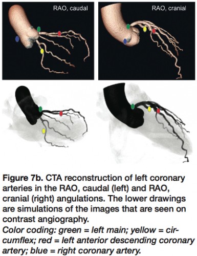 Angiographic Projections Made Simple: An Easy Guide to Understanding ...