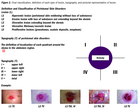 Peristomal Skin Issues