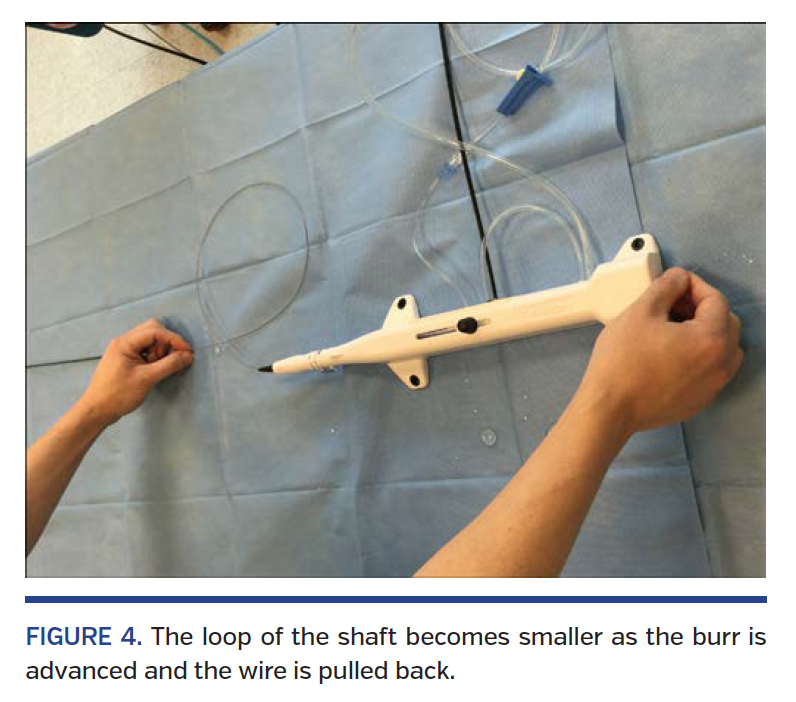 Novel Technique of Advancing the Rotational Atherectomy Device: "Single ...