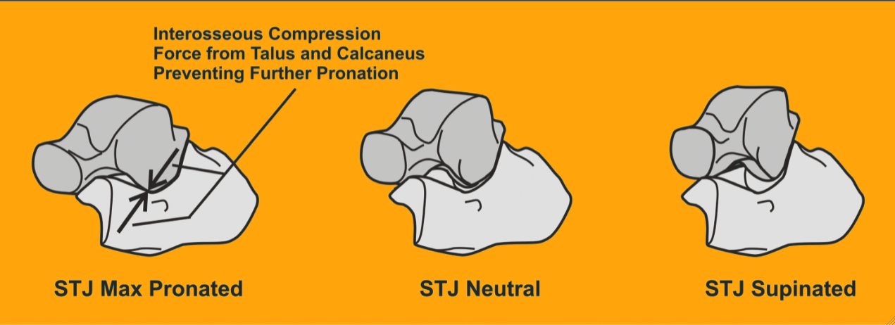 Understanding The Biomechanics Of Subtalar Joint Arthroereisis