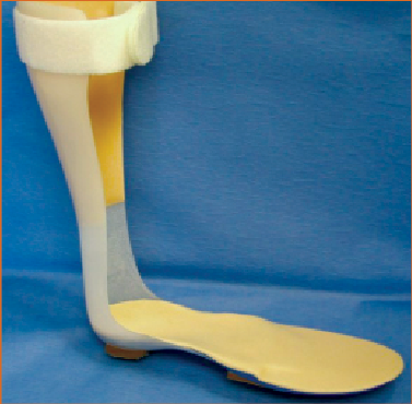 Current Concepts In Diagnosing And Treating Drop Foot