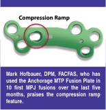 Can A New Plate Lead To Better Outcomes With First MPJ Fusion?