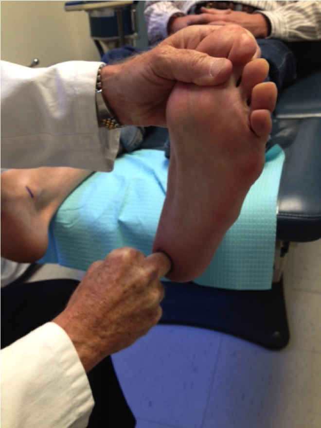 Treating A Runner With Proximal Plantar Fasciitis, Hip Pain And A Limb ...
