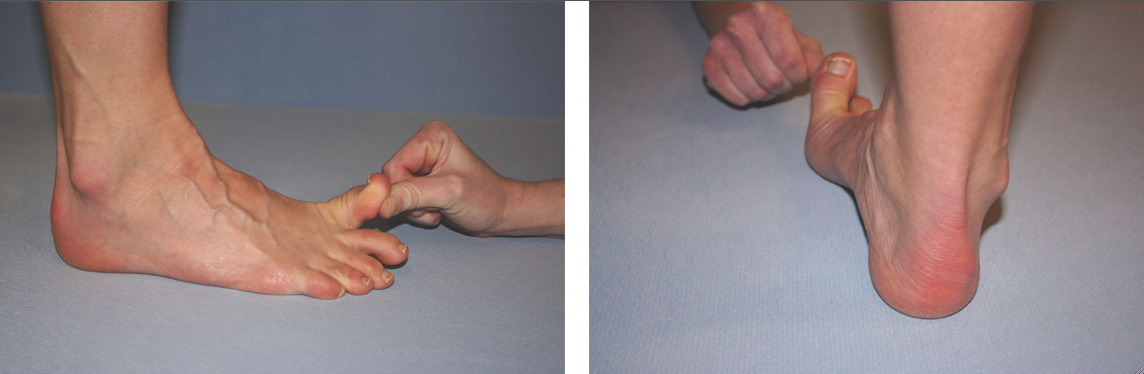 A Guide To Orthotic Therapy For Adult-Acquired Flatfoot