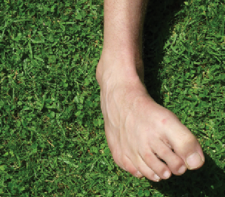 A Guide To Lower Extremity Muscle Testing