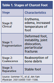 Managing Charcot Foot