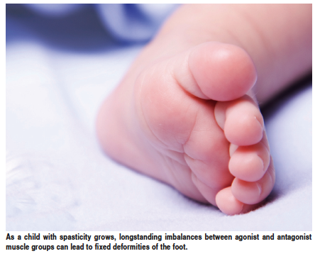 How To Address Spastic Gait In Children