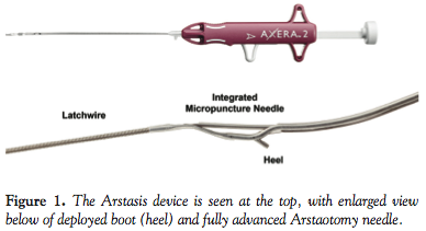 Use of a Novel Access Technology for Femoral Artery Catheterization ...