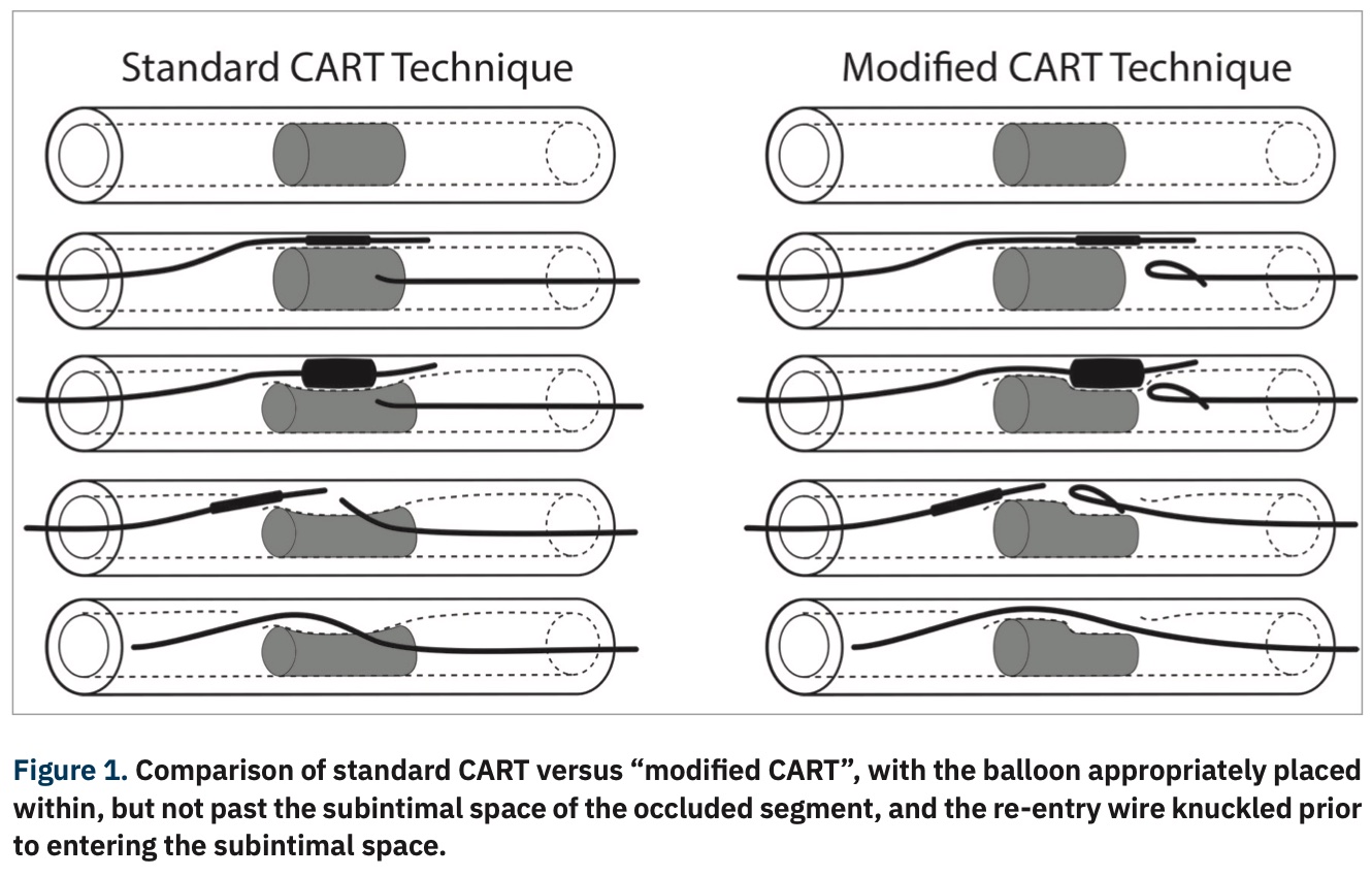 Modified CART Technique: How to Maximize the Efficiency of CART and ...