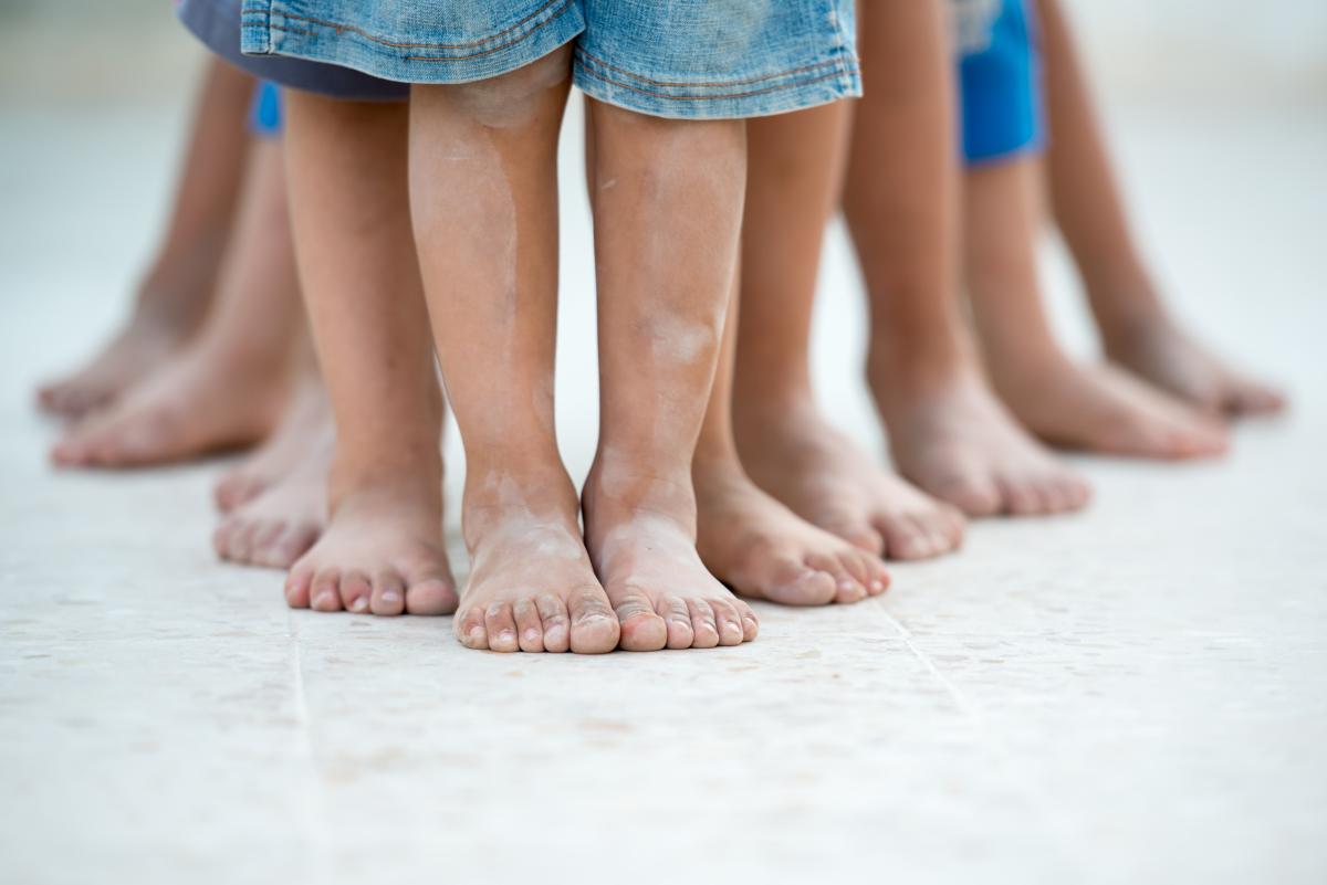Top Ten Lower Extremity Conditions In Pediatric Patients Top Ten Lower Extremity Conditions In Pediatric Patients