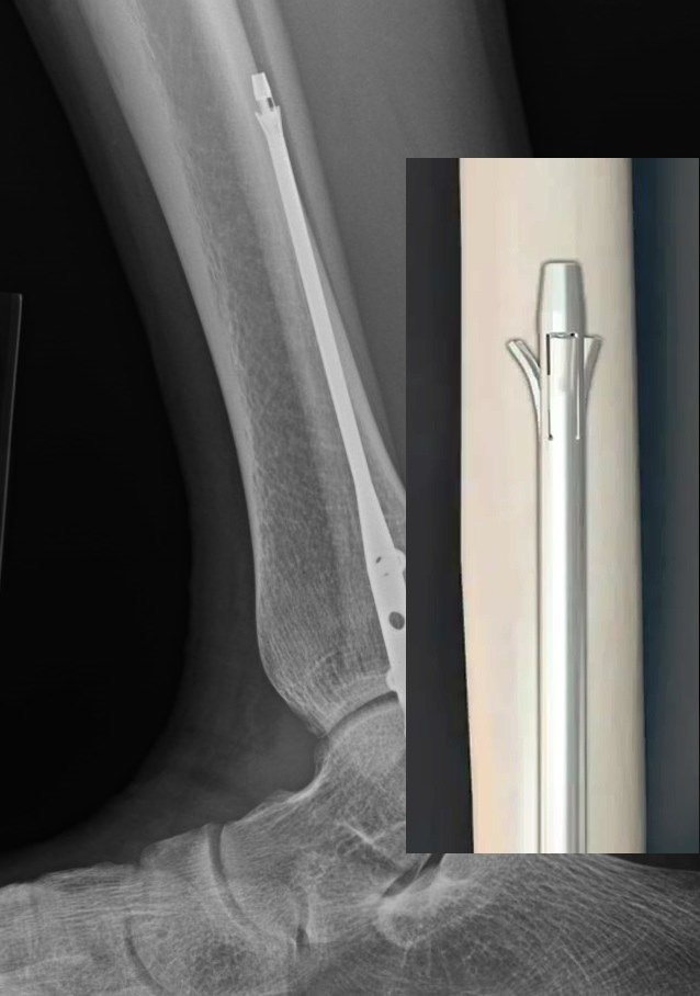 New Products September 2016