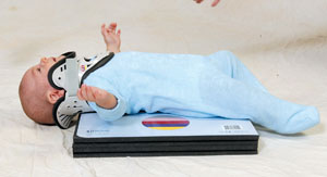 Big Head, Little Body Syndrome: What EMS Providers Need to Know