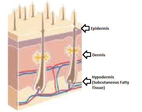 Thermal Burn Care: A Review of Best Practices