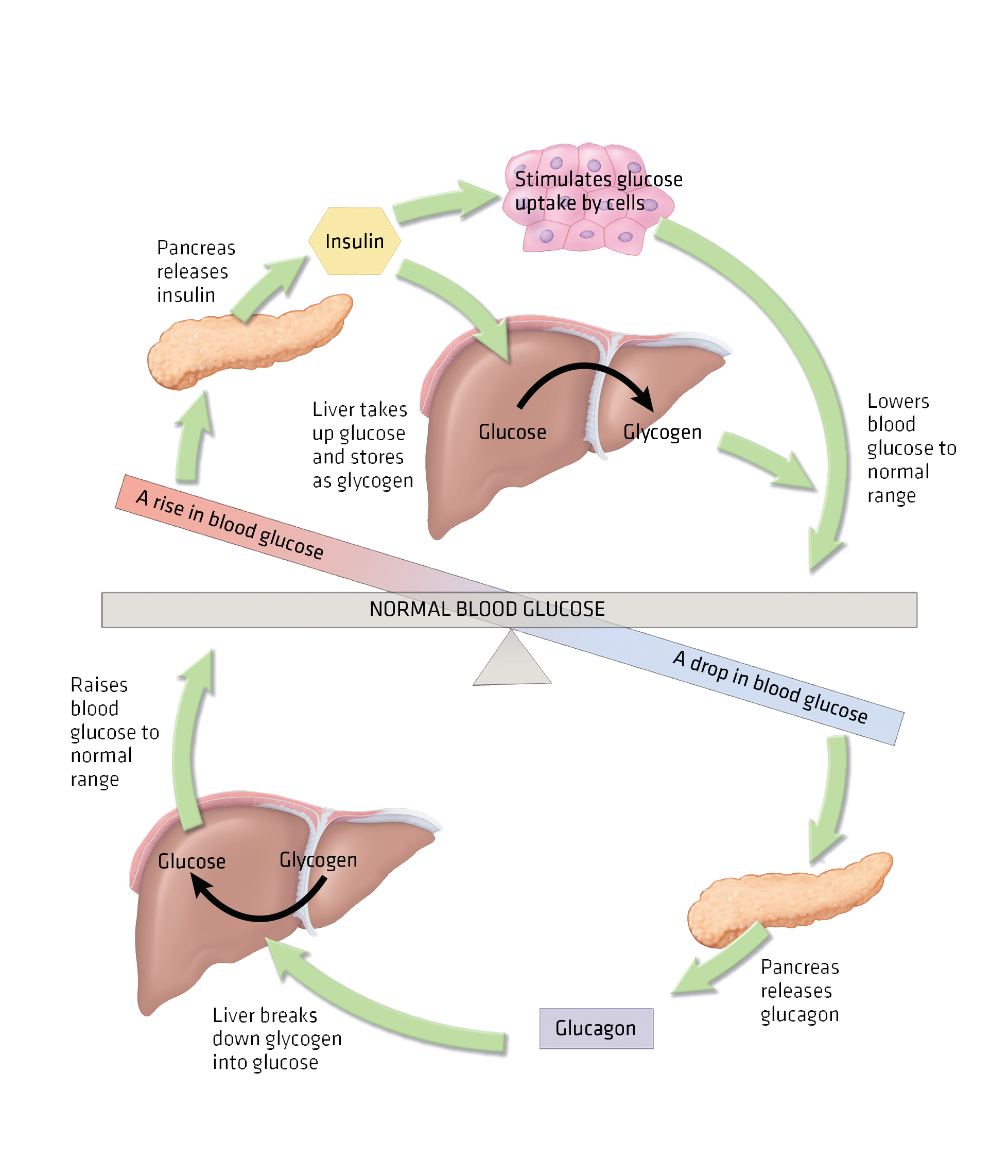 Hyperglycemia And What To Do About It