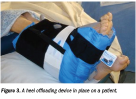Practice Recommendations for Preventing Heel Pressure Ulcers
