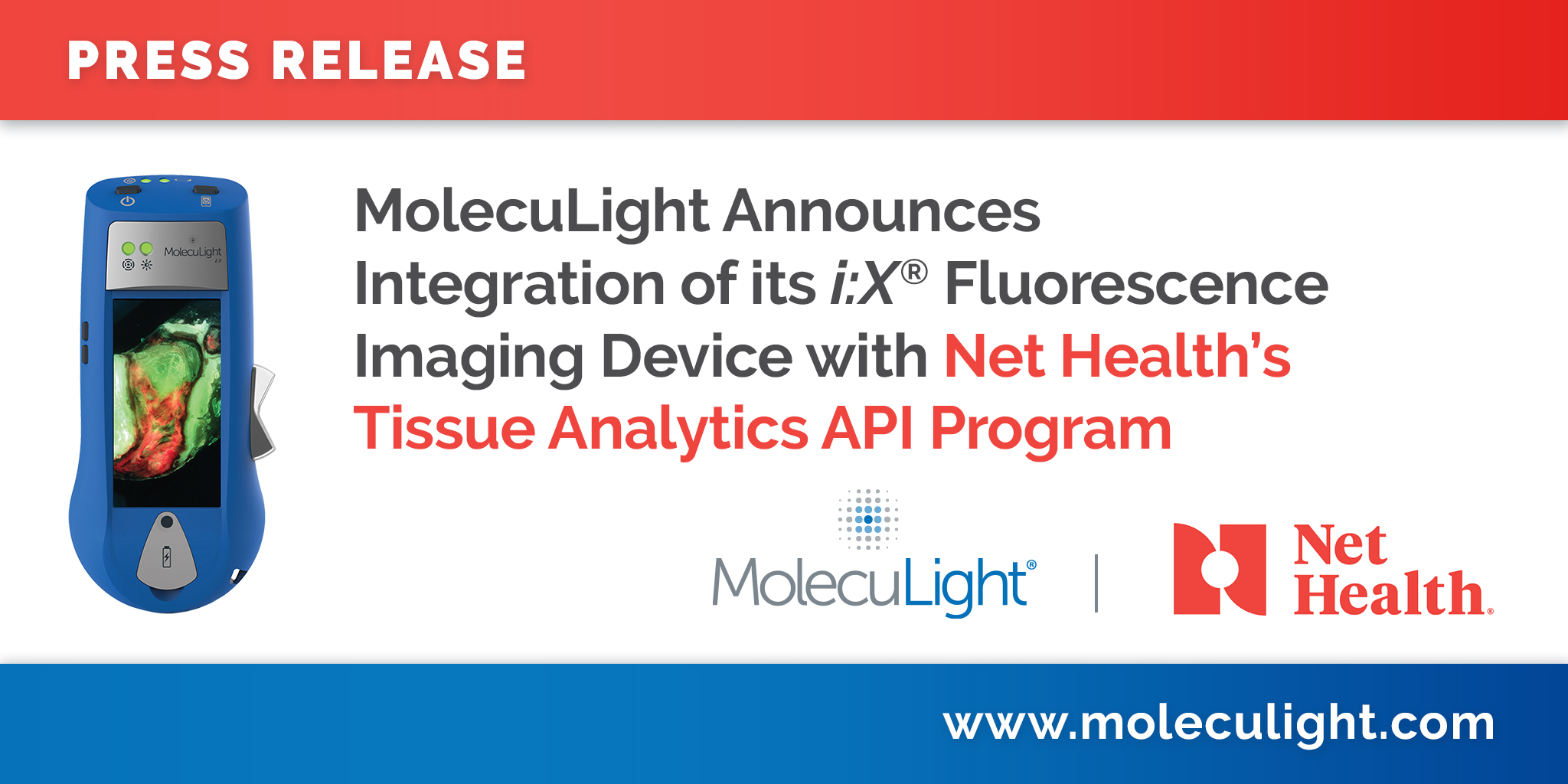 MolecuLight Announces Integration of its i:X® Fluorescence Imaging ...