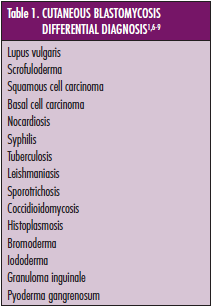 Treating Rare Fungal Infections: Cutaneous Blastomycosis