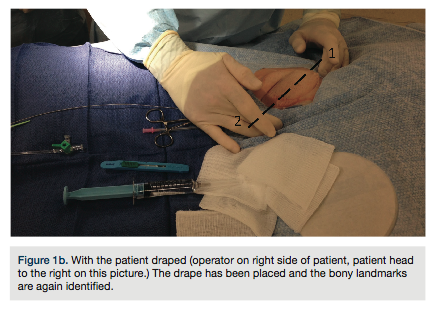 Back to Basics: Femoral Artery Access and Hemostasis