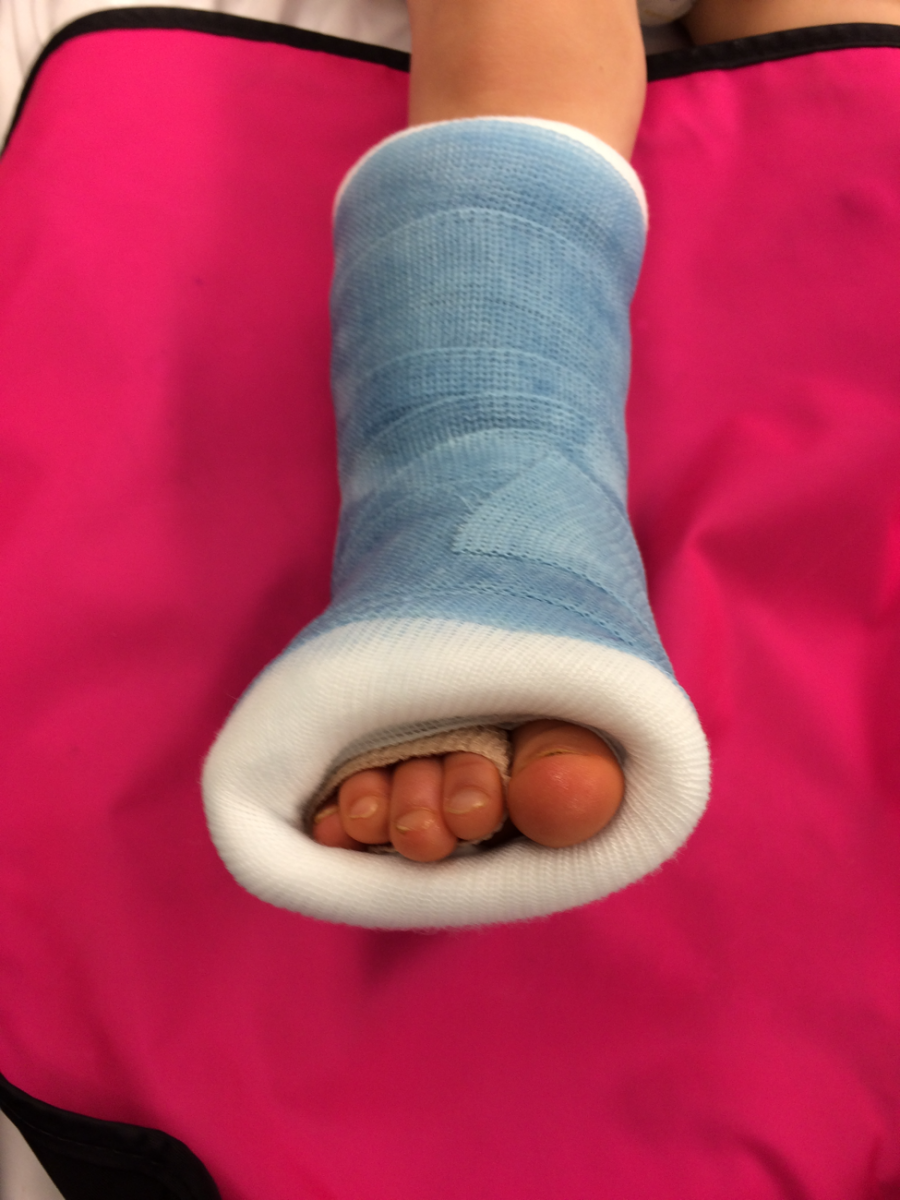 Deciding Which Digit To Remove In Patients With Polydactyly