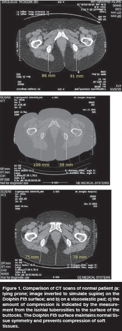 Notes on Practice: Use of Fluid Immersion Simulation to Optimize ...