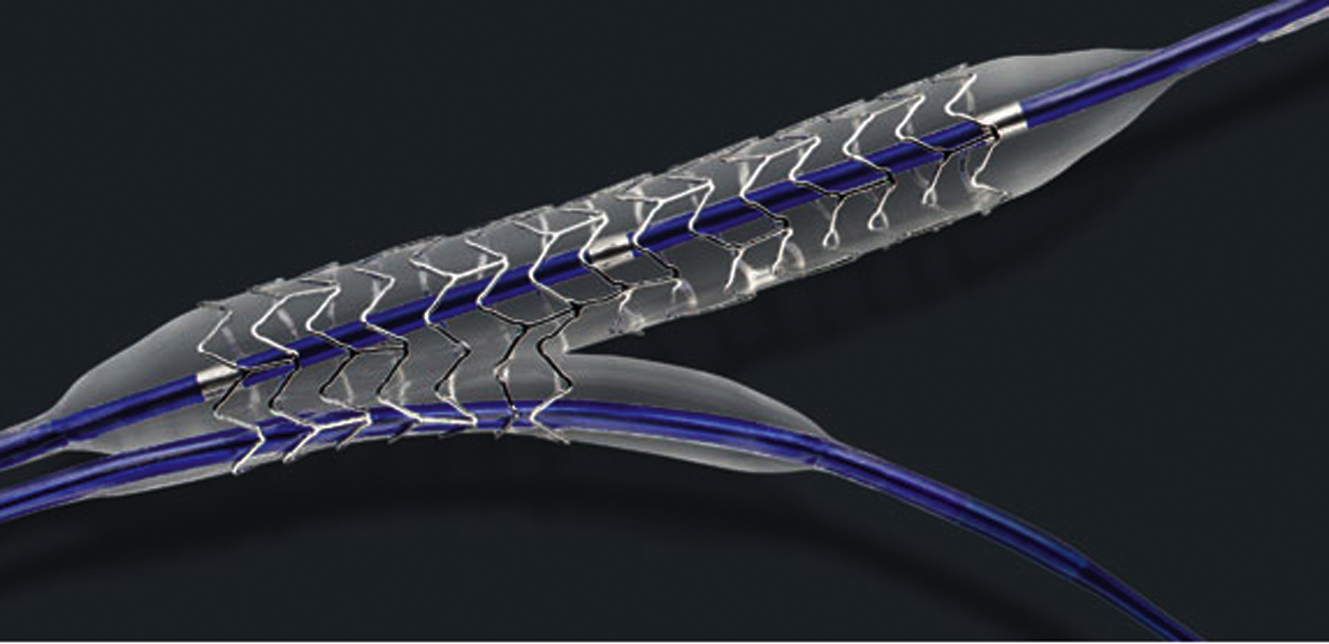 Transradial Treatment of Bifurcation Coronary Disease Using the Multi ...