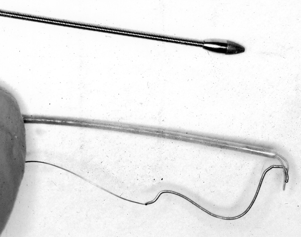 Snare Retrieval of the Distal Tip of a Fractured Rotational Atherectomy ...
