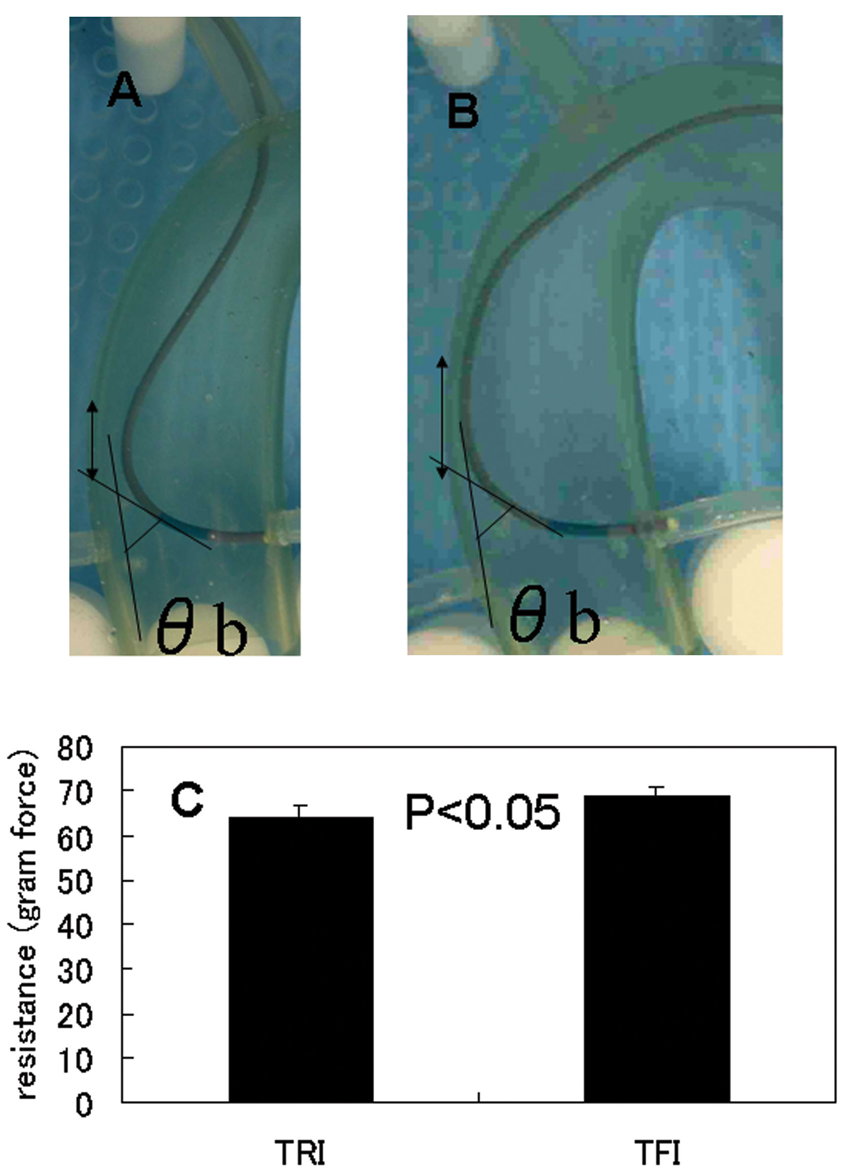 The Physics of Guiding Catheters for the Left Coronary Artery in ...