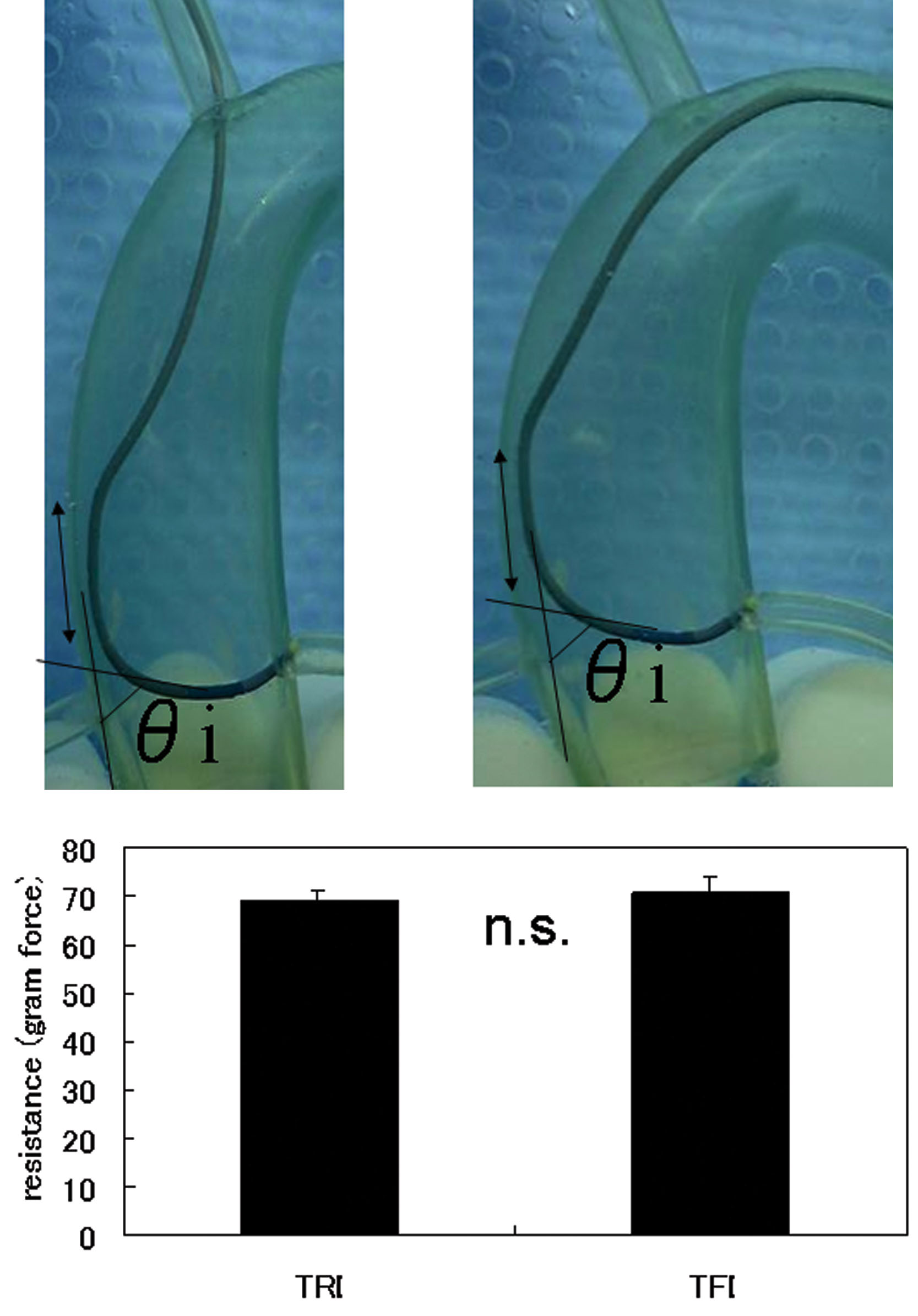 The Physics of Guiding Catheters for the Left Coronary Artery in ...