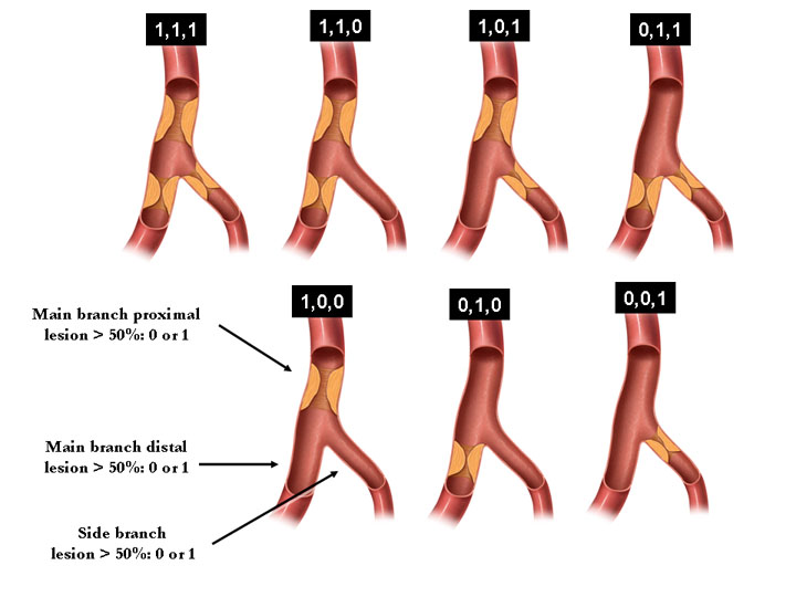 Bifurcation Coronary Artery Disease: Current Techniques and Future ...