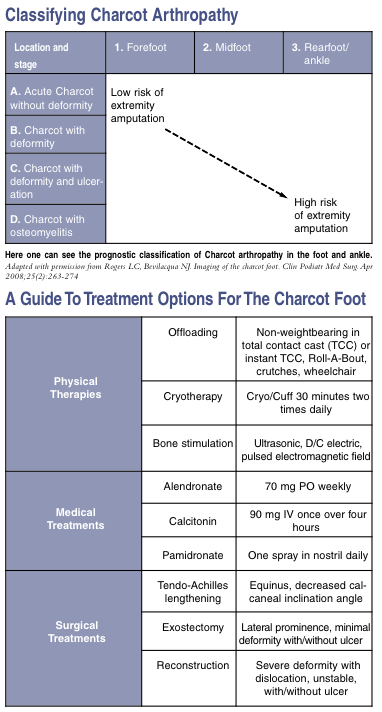 The Charcot Foot: What You Need to Know