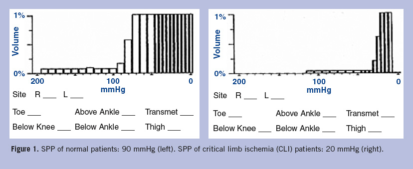 Importance of Skin Perfusion Pressure in Treatment of Critical Limb ...