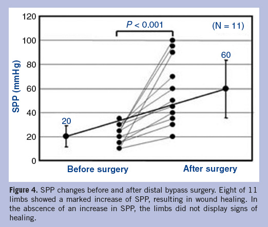 Importance of Skin Perfusion Pressure in Treatment of Critical Limb ...