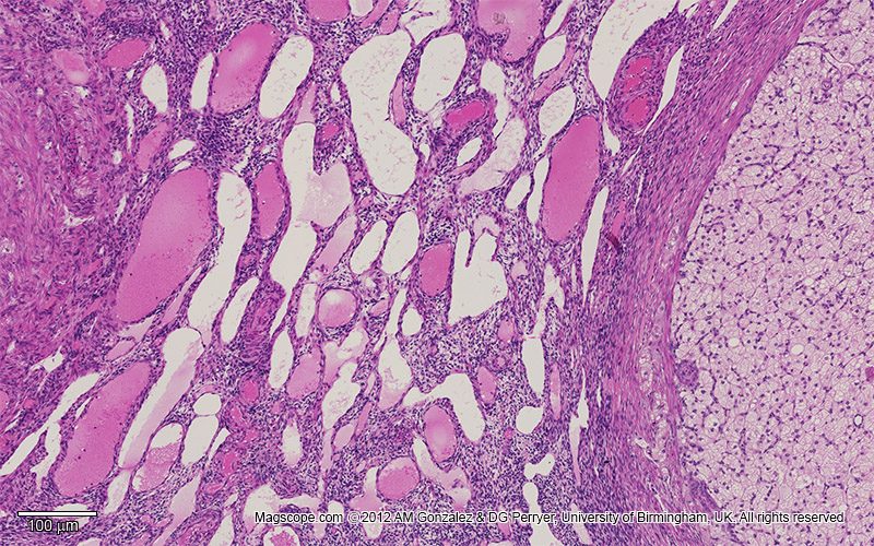 Low magnification micrograph of the ovarian hilum