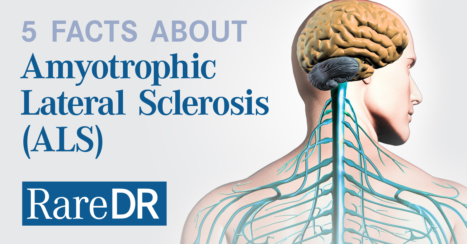 Five Facts About Amytrophic Lateral Sclerosis ALS Infographic Five Facts About Amytrophic Lateral Sclerosis ALS Infographic