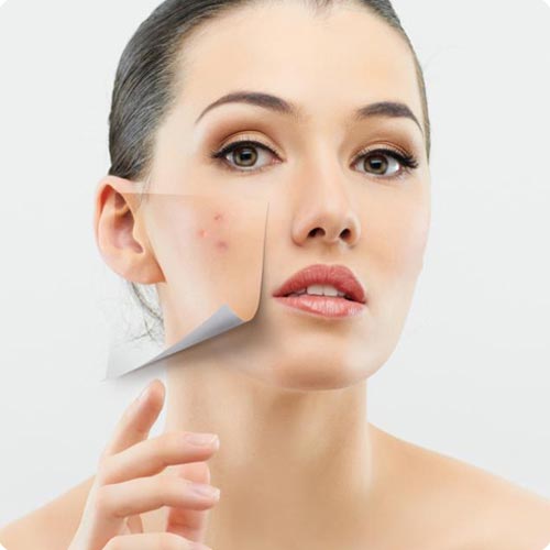 Symptoms of Skin Problem, How to Cure & Get Treatment of Skin Problem ...