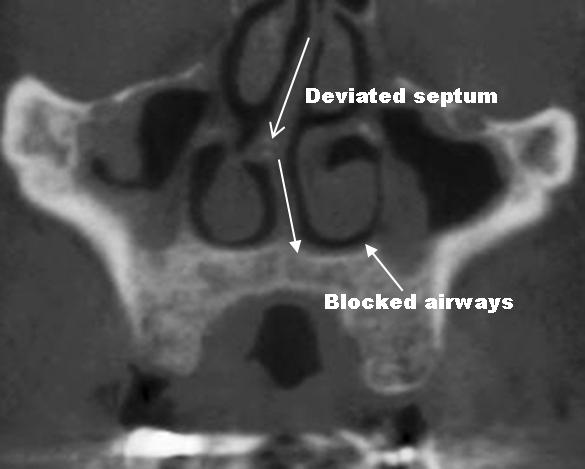 3D Imaging Orthodontic Treatment Affiliated Orthodontics