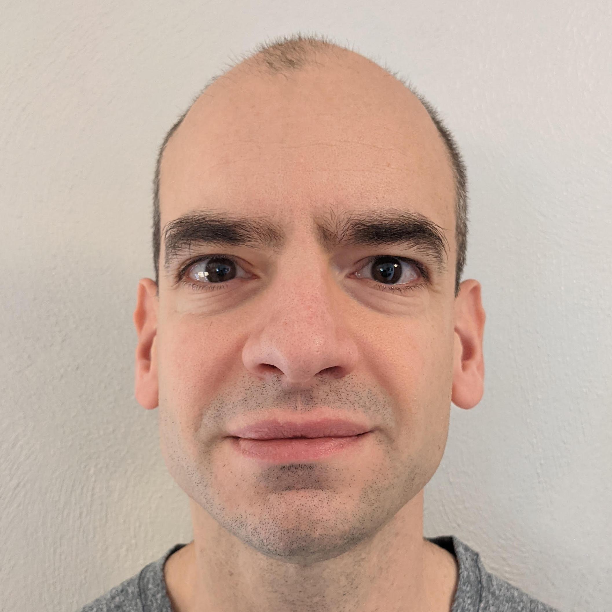 Grafana Loki OSS | Log aggregation system