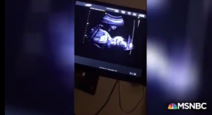 Katy Tur: ‘I Have a Baby in my Belly … Officially’