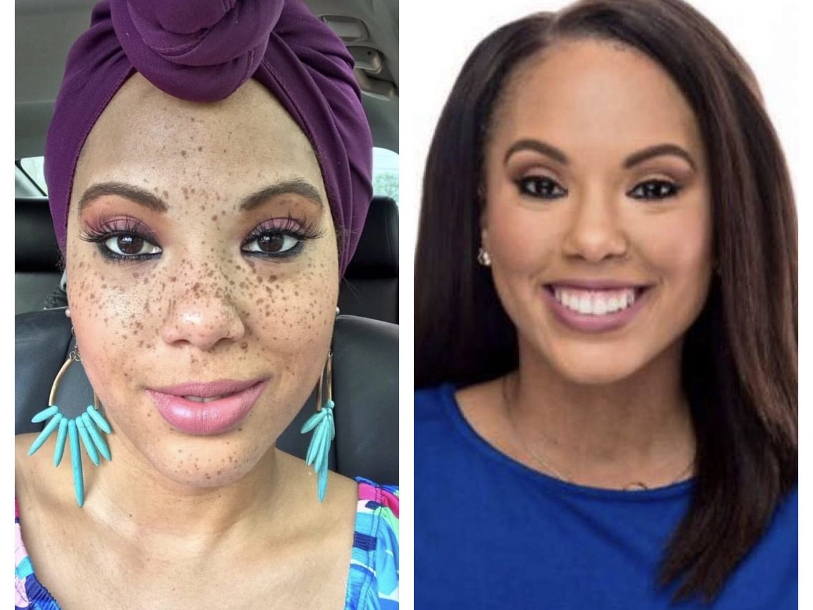 Houston Reporter Reveals ‘Off Day’ Freckles