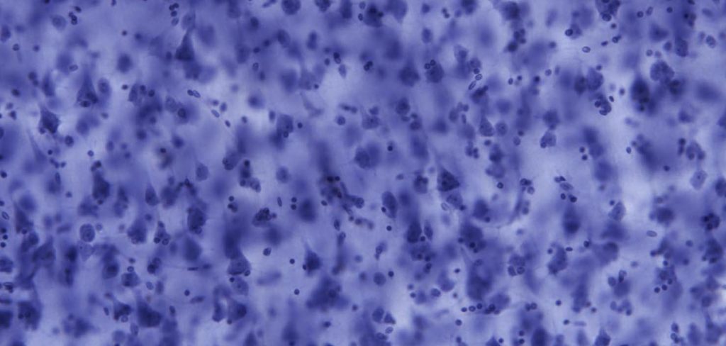 Autism BrainNetAutism BrainNet to digitize the Autism Celloidin Libray ...