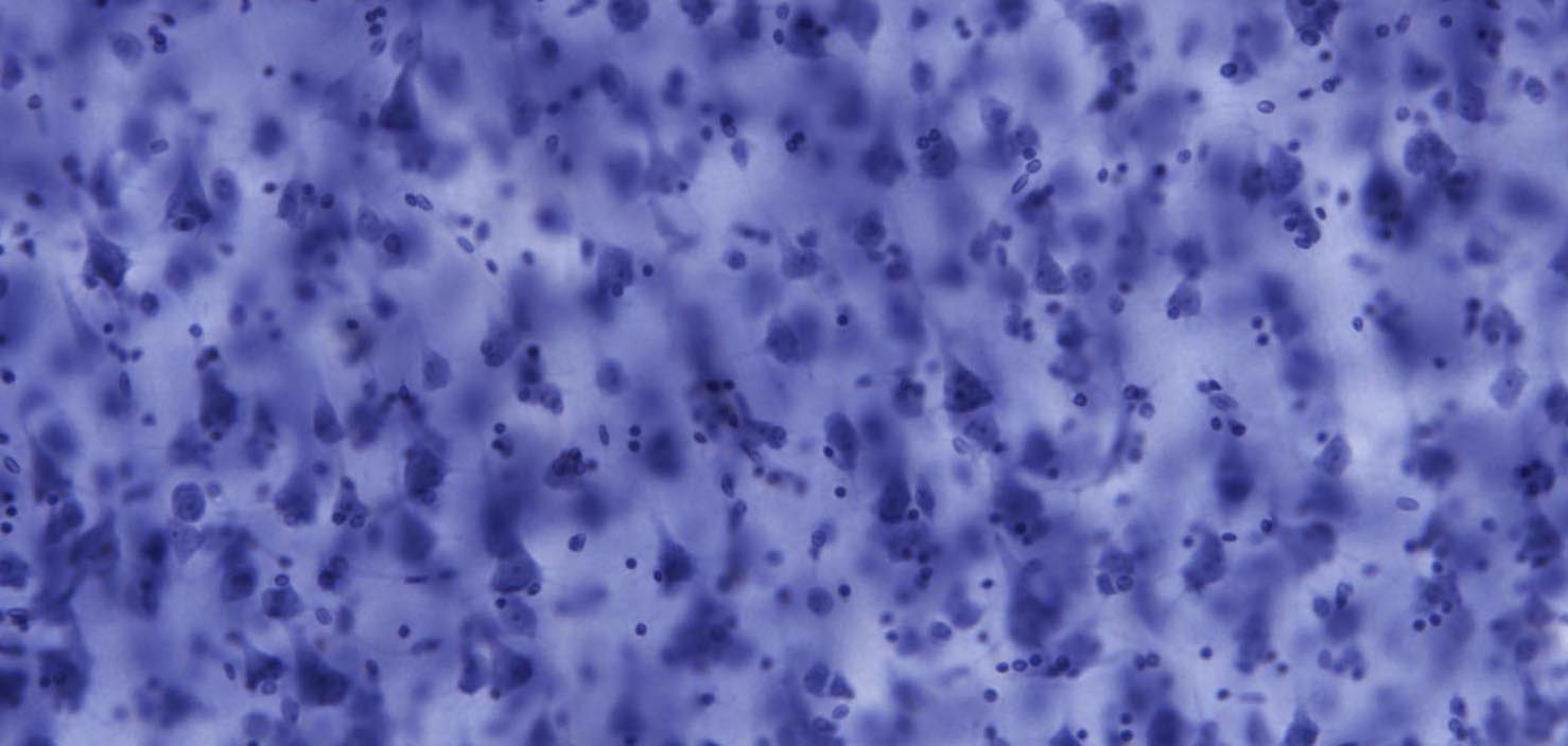 Autism BrainNetAutism BrainNet to digitize the Autism Celloidin Libray ...