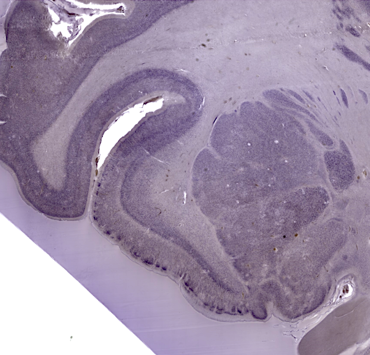 Autism BrainNetAutism BrainNet to digitize the Autism Celloidin Libray ...