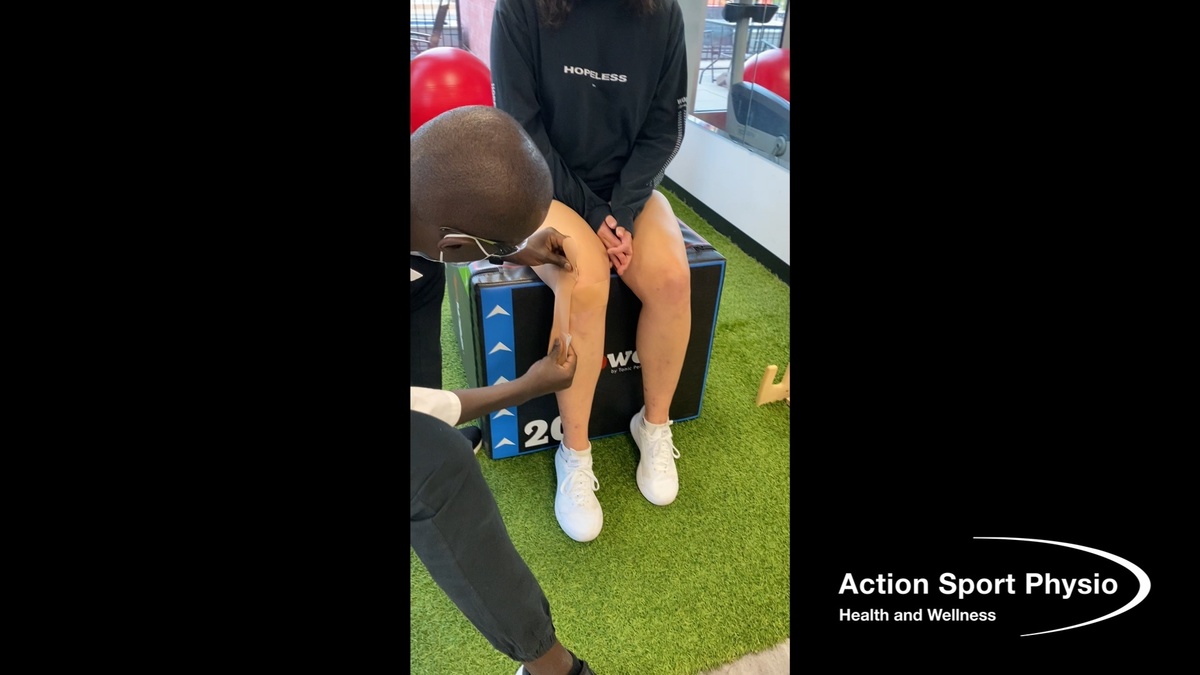 Video: Knee taping and braces | Action Sport Physio