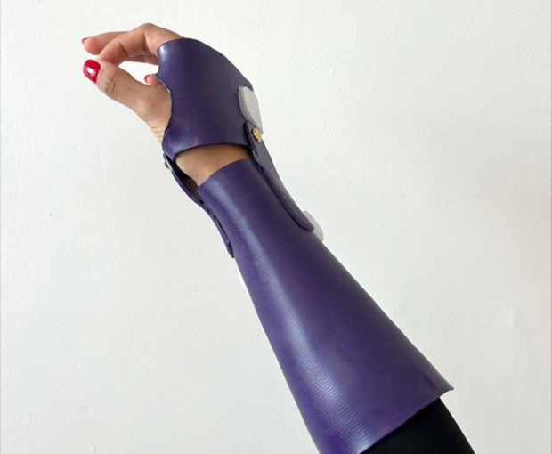 Splinting And Occupational Therapy | Action Sport Physio